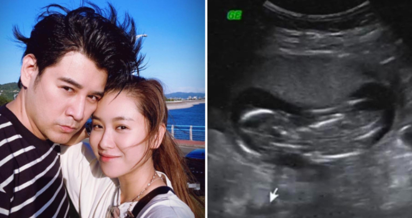 突懷第3胎！44歲本土女星辦「性別揭曉趴」 氣球一戳破親友全震驚 - Qoo | FUN01 創作分享