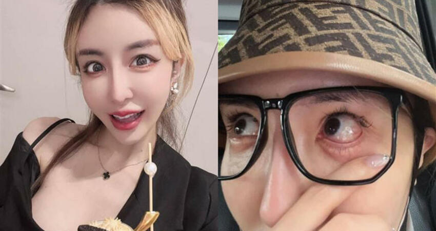 整形狂燒百萬！雪碧崩潰認「眼睛閉不起來長達半年」 驚悚慘況曝光 - Qoo | FUN01 創作分享