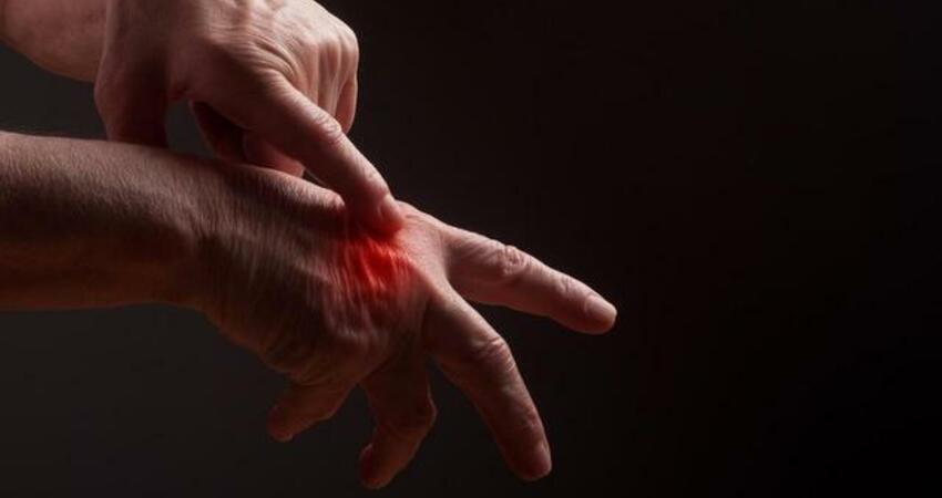 今日良方妙用：治療風濕病 - zx | FUN01 創作分享